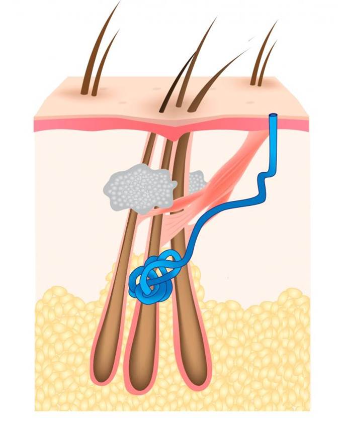 ¿Qué es una unidad folicular? - Tricología y Trasplante Capilar Mir